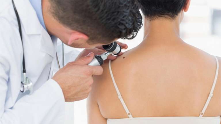 Corn vs Callus vs Wart vs Other - Advanced Dermatology of the Midlands